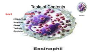 Eosinopenia | PPTX