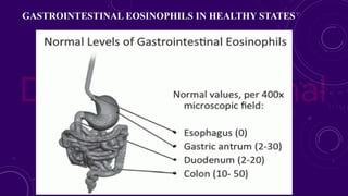 eosinophilic esophagitis by Dr. Mahmoud jamal .pptx