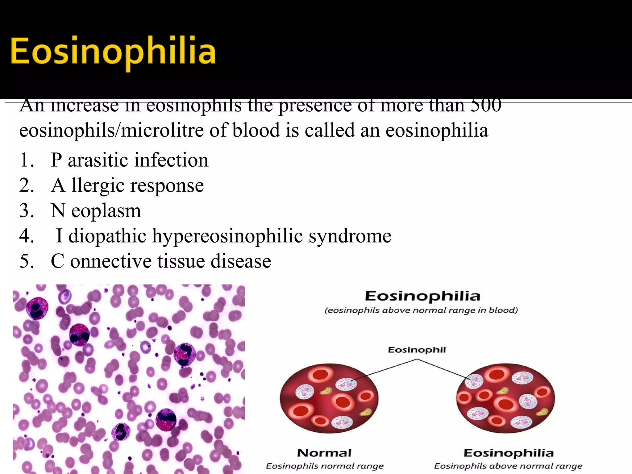 Eosinophils and Eosinophilia | PPT