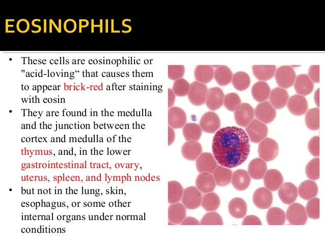 Eosinophilia Meaning