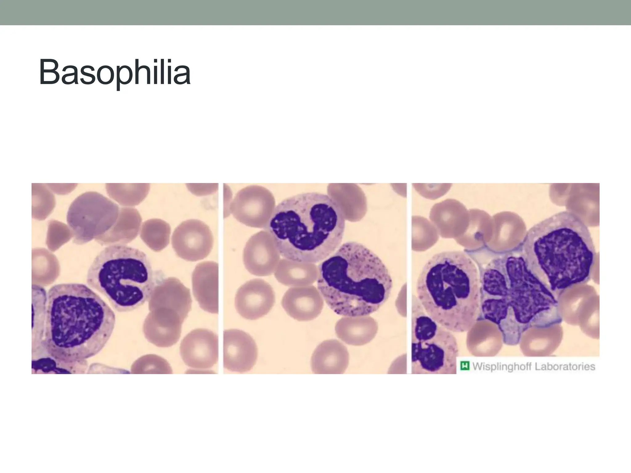 Eosinophils and BASOPHILSkhadeejaimad.pptx