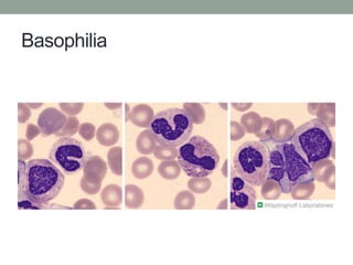 Eosinophils and BASOPHILSkhadeejaimad.pptx | Blood Disorders | Diseases ...