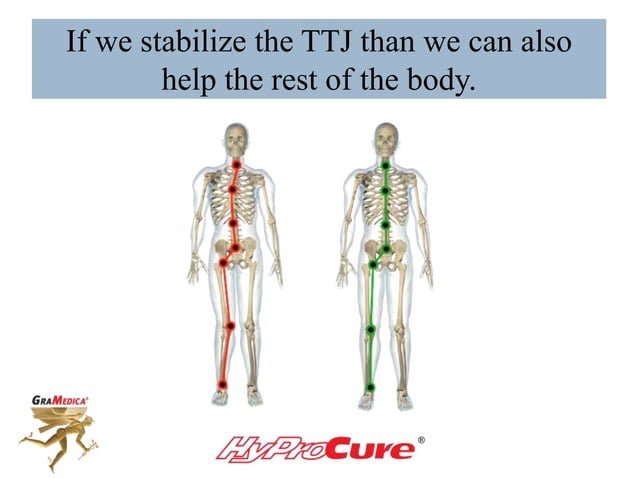 HyProCure Before & After | PPT