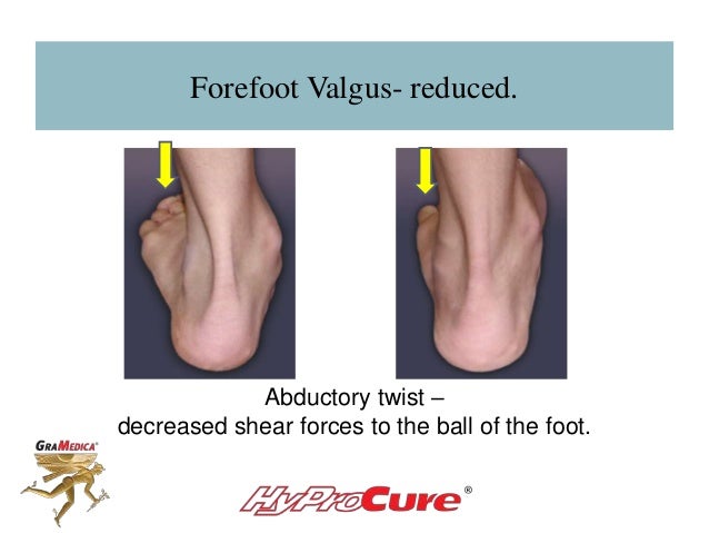 HyProCure Before & After