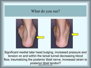 HyProCure Before & After | PPTX | Death, Injury, or Military Conflict ...