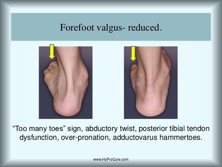 HyProCure Before & After