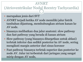 AVNRT | PPTX