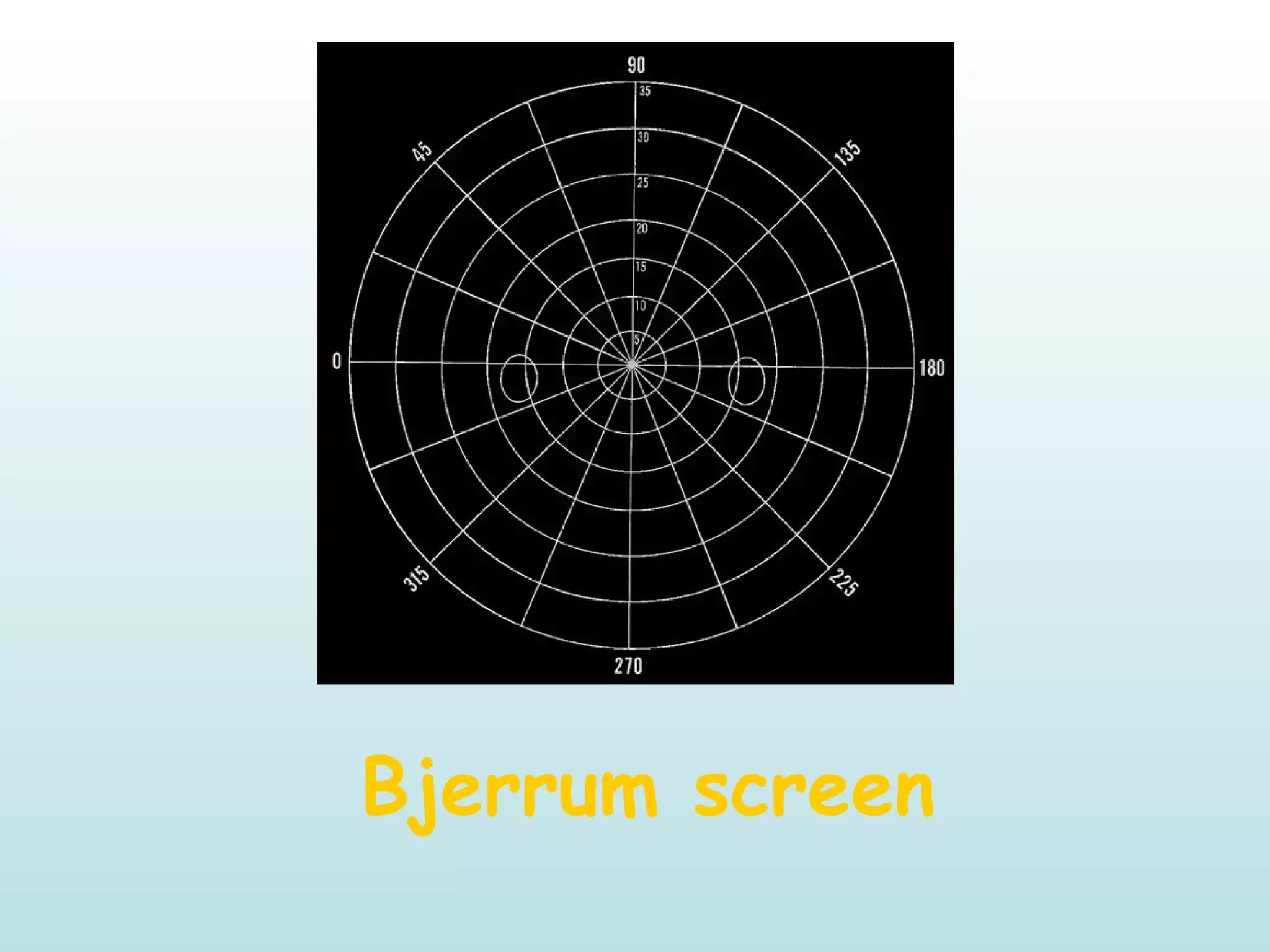Ophthalmology Eponyms II ! | PPT