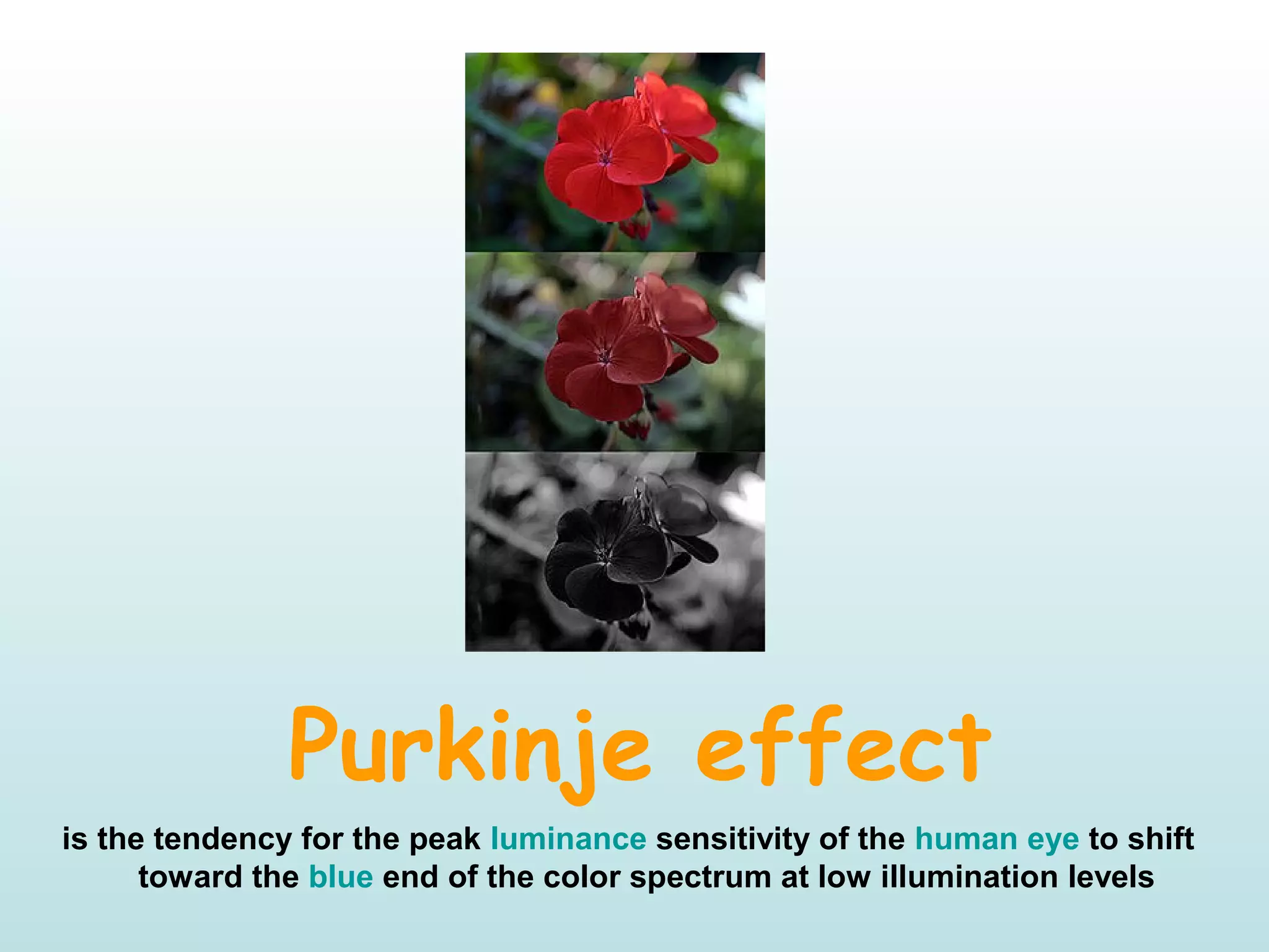 Ophthalmology Eponyms II ! | PPT