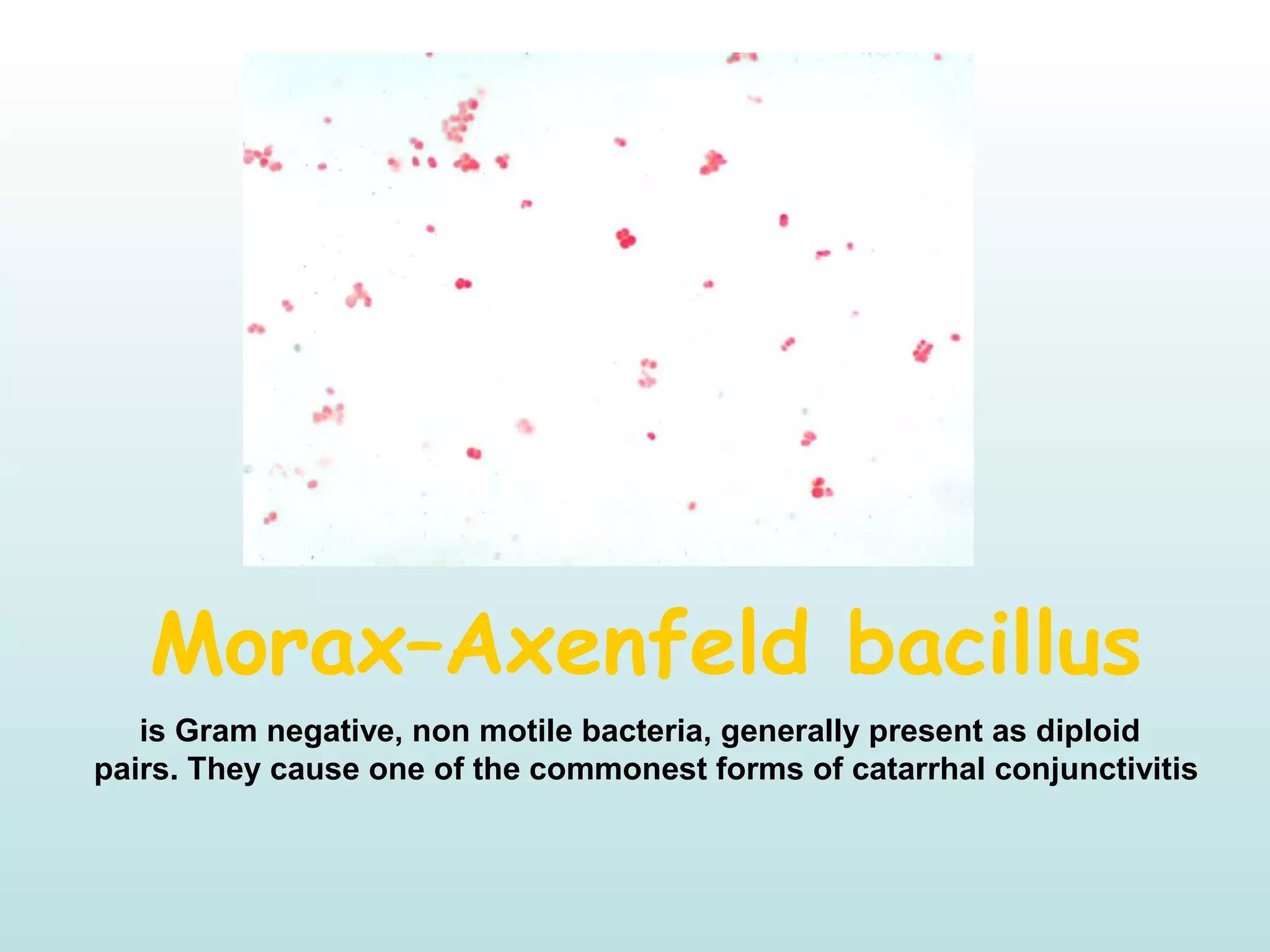 Ophthalmology Eponyms II ! | PPT