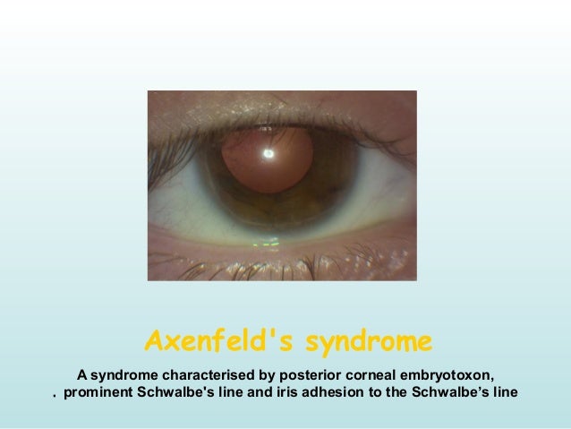 Ophthalmology Eponyms II