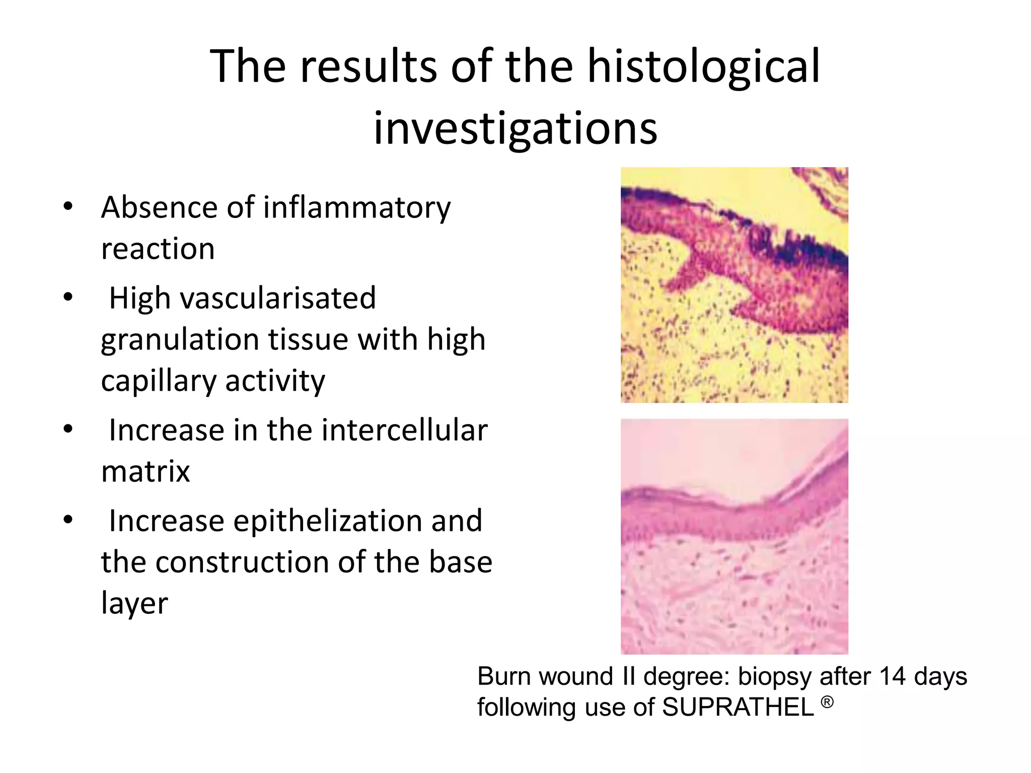 EWMA 2013-Ep437-APPLICATION OF SUPRATHEL® IN TREATMENT OF CHILDREN WITH ...