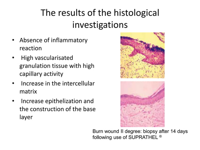 EWMA 2013-Ep437-APPLICATION OF SUPRATHEL® IN TREATMENT OF CHILDREN WITH ...