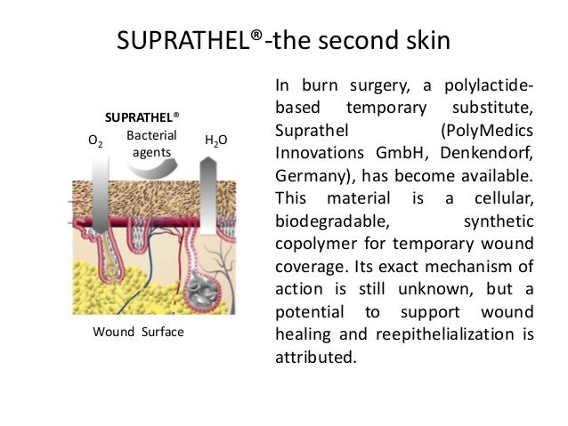EWMA 2013-Ep437-APPLICATION OF SUPRATHEL® IN TREATMENT OF CHILDREN WI…