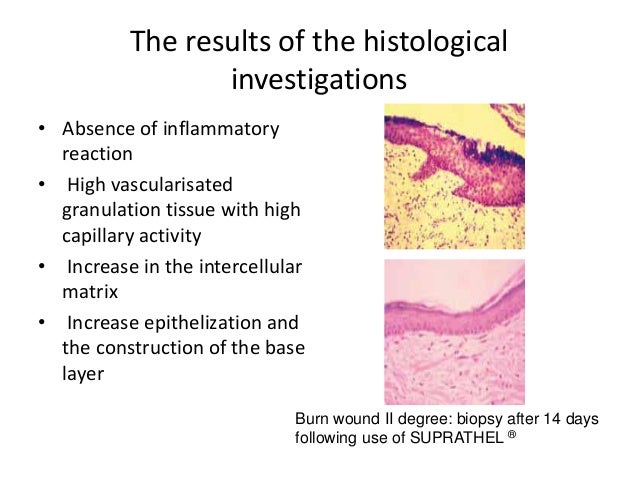 EWMA 2013-Ep437-APPLICATION OF SUPRATHEL® IN TREATMENT OF CHILDREN WI…