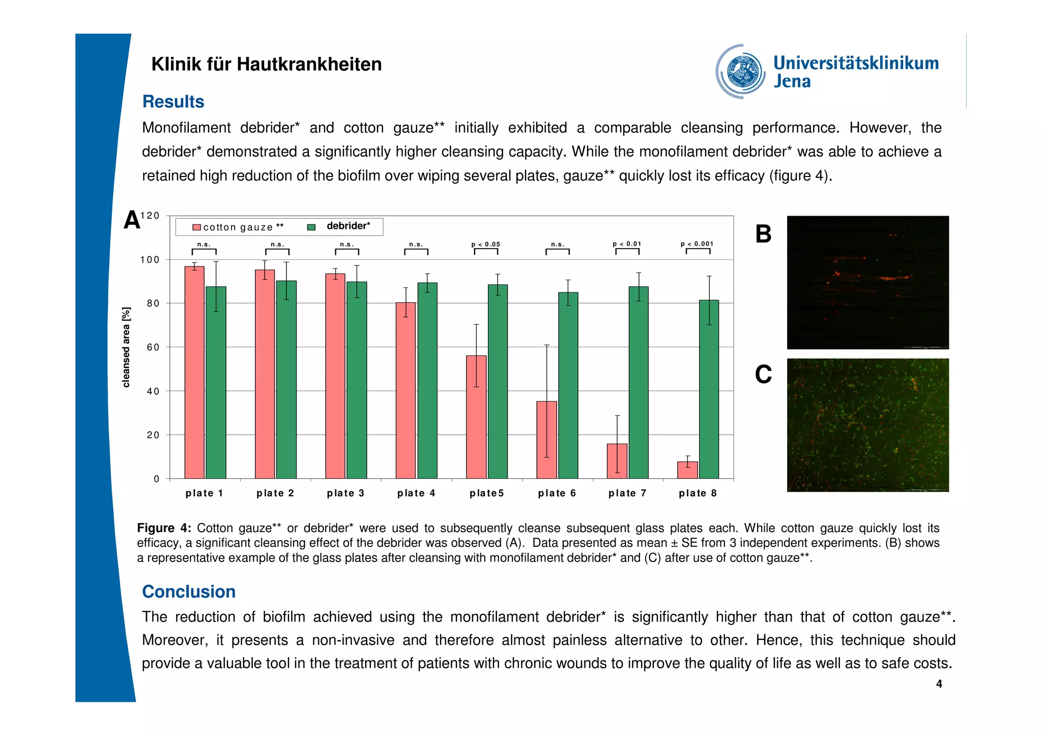 EWMA 2014 - EP443 DETERMINATION OF THE REDUCTION OF BIOFILM IN VITRO ...