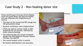 EWMA 2013-Ep446-ULTRASONIC ASSISTED WOUND DEBRIDEMENT – AN AUSTRALIAN ...