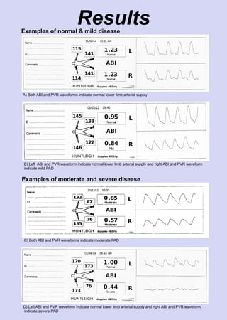 EWMA 2014 - EP452 DO ABI AND PULSE VOLUME COMPARE WITH THE DUPLEX SCAN ...