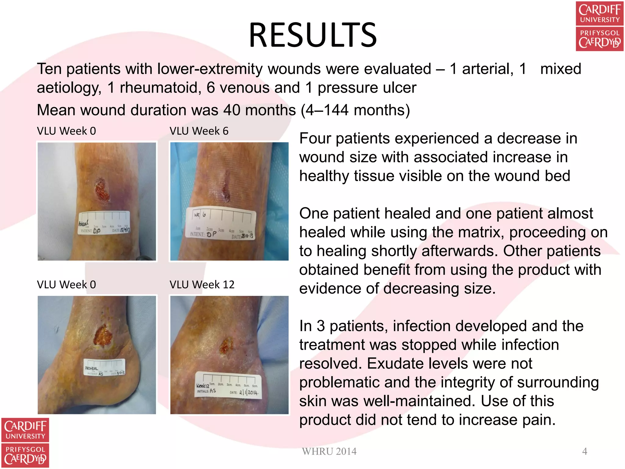 EWMA 2014 - EP454 EXPERIENCES WITH USING A COLLAGEN WOUND MATRIX* ON ...