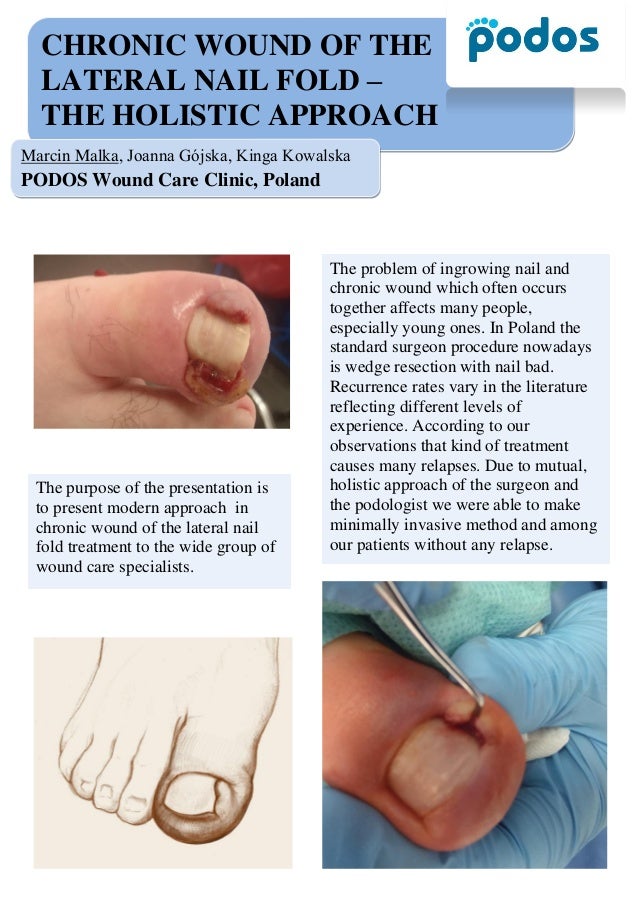 EWMA 2014 - EP458 CHRONIC WOUND OF THE LATERAL NAIL FOLD- THE HOLISTI…