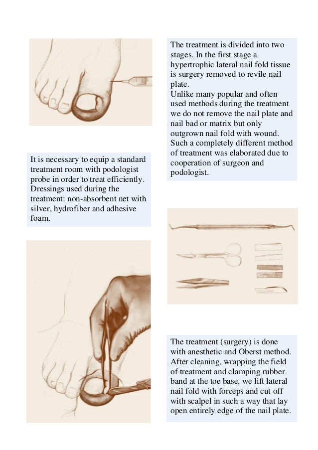 EWMA 2014 - EP458 CHRONIC WOUND OF THE LATERAL NAIL FOLD- THE HOLISTI…