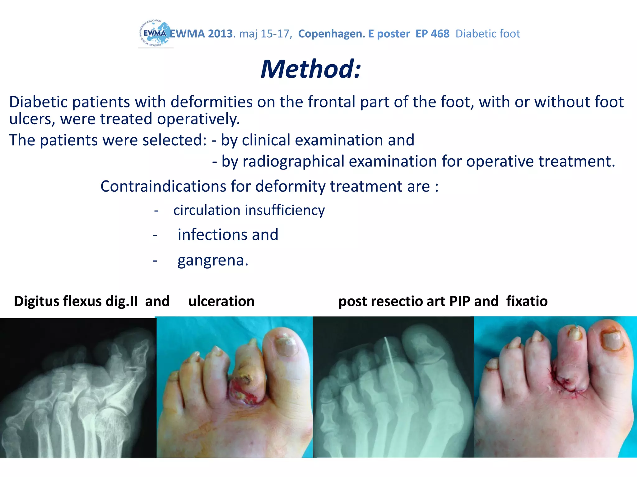EWMA 2013 - Ep468 - Corrective treatment of deformities in diabetic ...