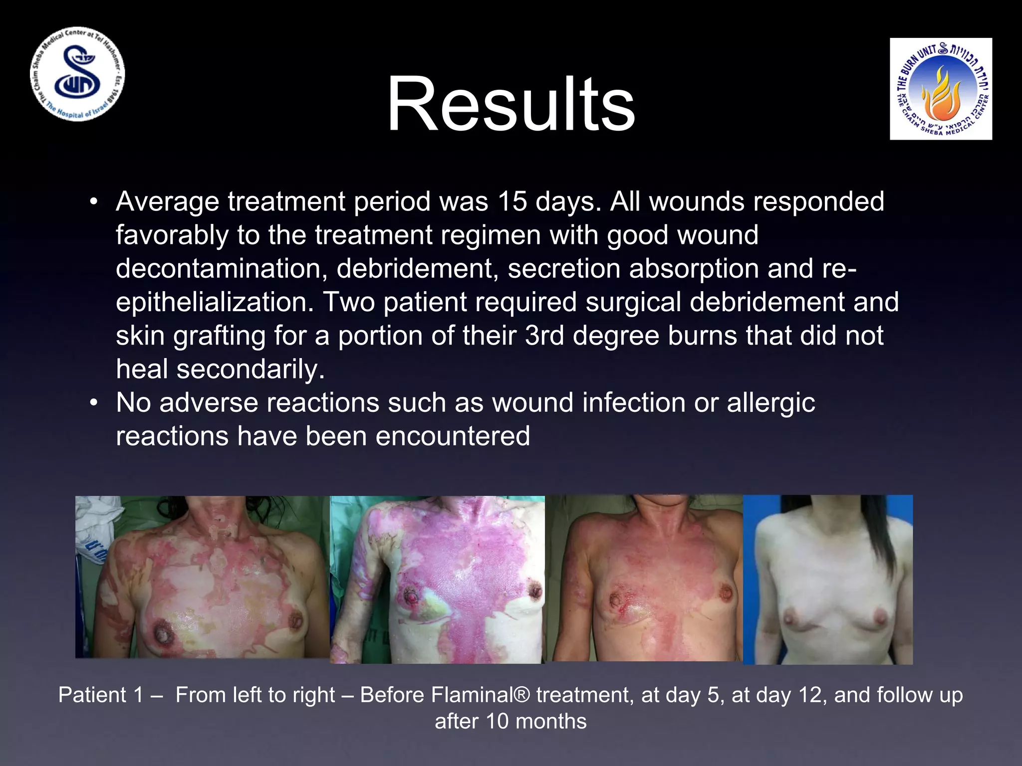 EWMA 2013 - Ep470 - Our Experience with the Treatment of Severe 2nd and ...