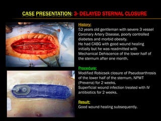 EWMA 2013 - Ep489 - Guidelines for the use of an incision management ...