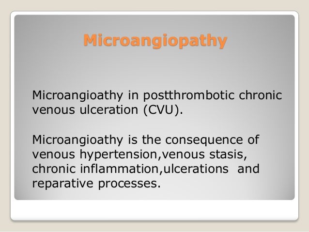 EWMA 2013 - Ep516 - Dermoscopy diagnostic method of microangiopathy i…