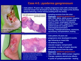 EWMA 2013 - Ep519 - DIFFERENTIAL DIAGNOSIS OF LEG ULCERS - ULCERS OF ...