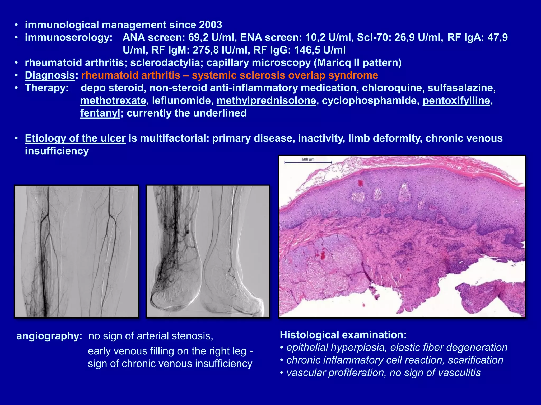 EWMA 2013 - Ep519 - DIFFERENTIAL DIAGNOSIS OF LEG ULCERS - ULCERS OF ...