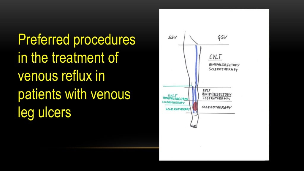 EWMA 2013 - Ep523 - SURGICAL TREATMENT OF VENOUS REFLUX IN PATIENTS W…