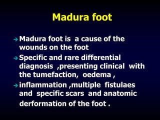 EWMA 2013 - Ep524 - MADURA FOOT- as differential diagnosis of the ...