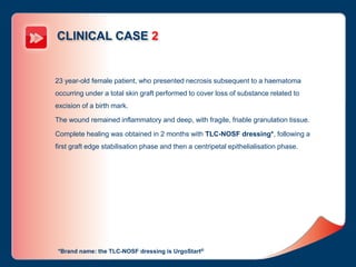 EWMA 2013 - Ep559 - OUR EXPERIENCE IN THE HEALING OF TRAUMATIC WOUNDS ...