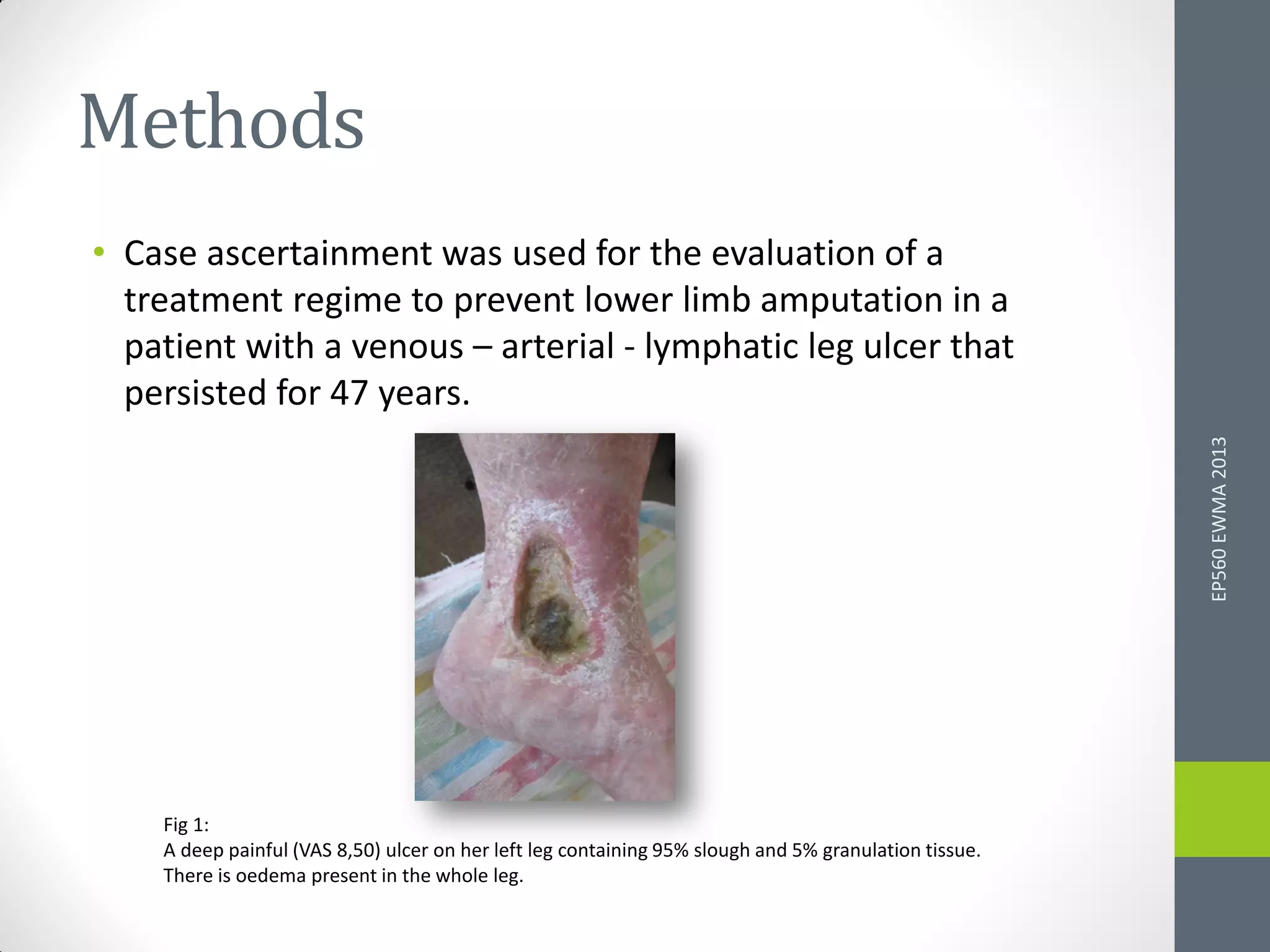 EWMA 2013 - Ep560 - LIVING WITH A VENOUS ARTERIAL LYMPHATIC ULCER FOR ...