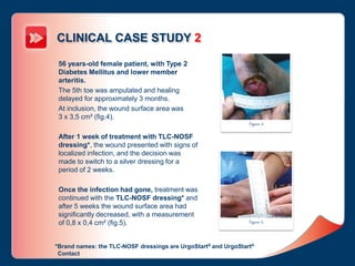 EWMA 2013 - Ep561 - EXPERIENCE OF THE TLC-NOSF DRESSING* IN THE ...