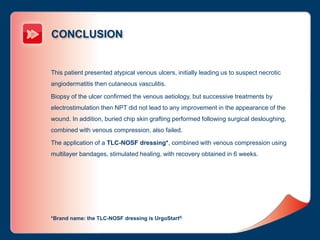 EWMA 2013 - Ep562 - MANAGEMENT OF AN ATYPICAL VASCULAR ULCER WITH TLC ...