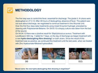 EWMA 2013 - Ep565 - TREATMENT OF PRESSURE ULCERS IN TOES WITH A NEW ...
