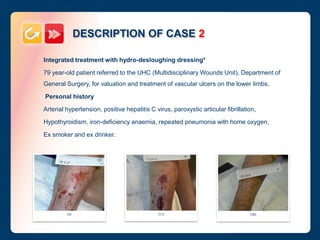 EWMA 2013 - Ep566 - SEQUENTIAL TREATMENT OF CHRONIC WOUNDS WITH HYDRO ...