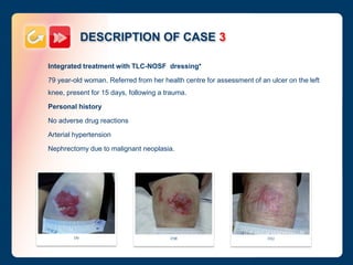 EWMA 2013 - Ep566 - SEQUENTIAL TREATMENT OF CHRONIC WOUNDS WITH HYDRO ...