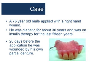 EWMA 2013 - Ep575 - A case of diabetic hand wound | PDF