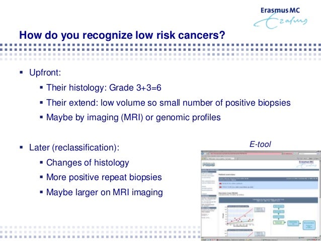 Active Surveillance For Prostate Cancer