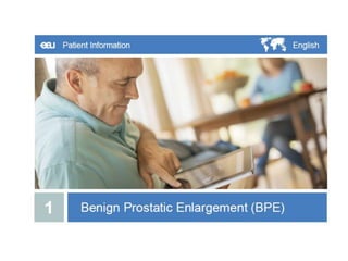 Management of Male Benign Prostatic Enlargement | PPT