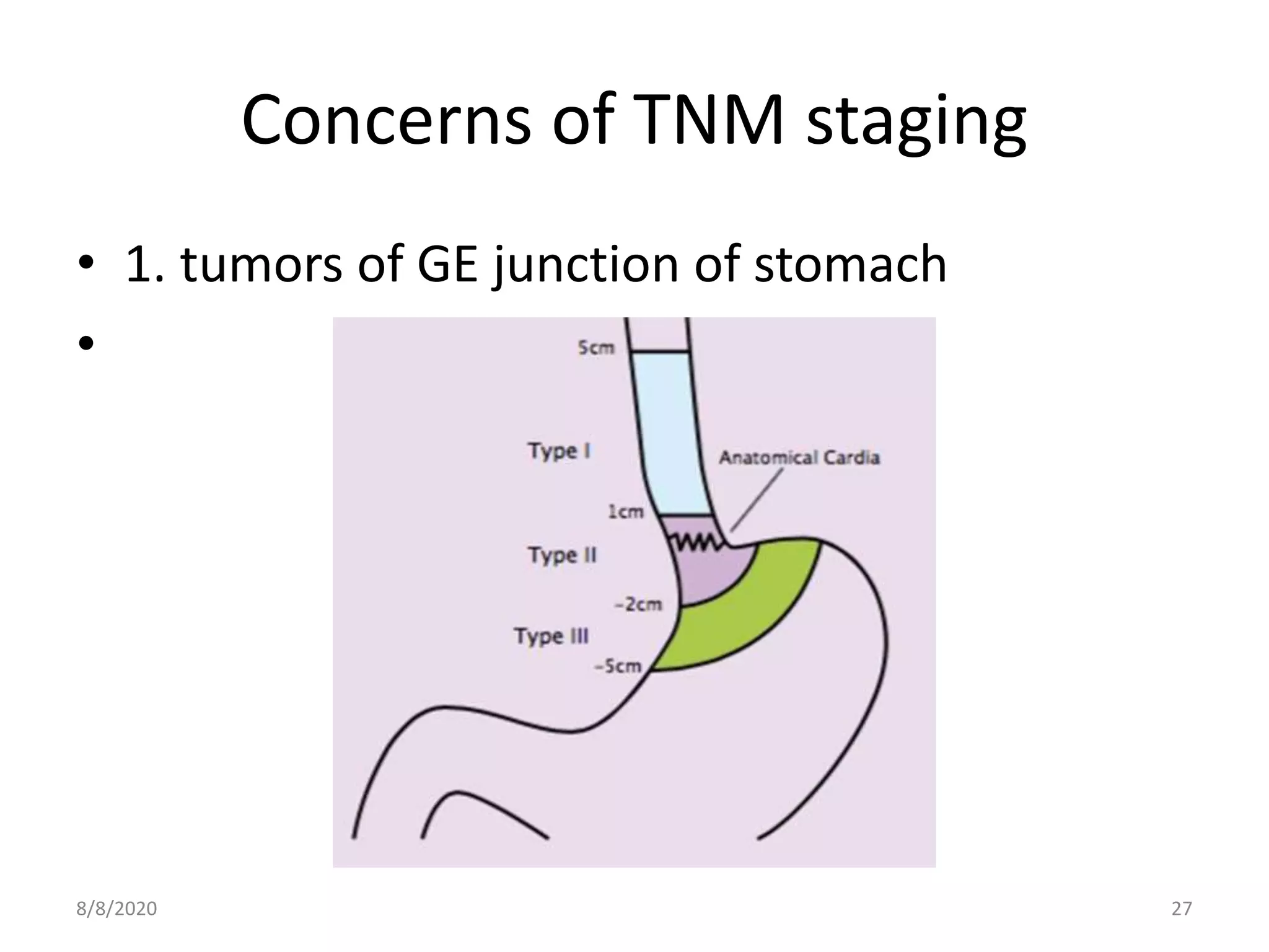(E)pathology of gastric cancer | PPTX