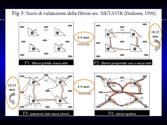 Epatite cronica HCV corelata storia naturale 2007 | PPT