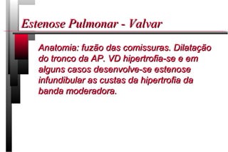 Coarctação da Aorta, Arco Aórtico interrompido e Estenose Pulmonar, | PPT
