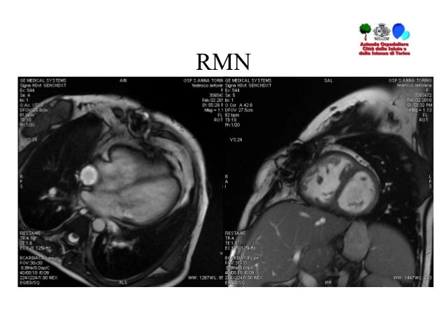 ENTEROPATIA PROTEINO DIPENDENTE