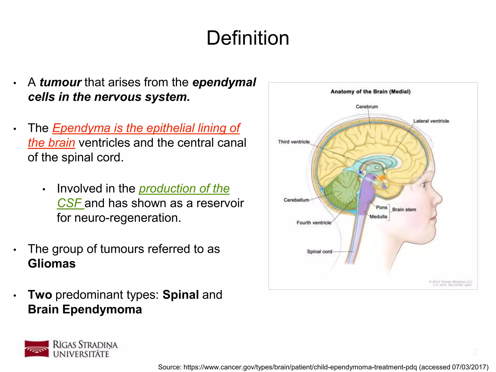 Ependymoma | PPTX