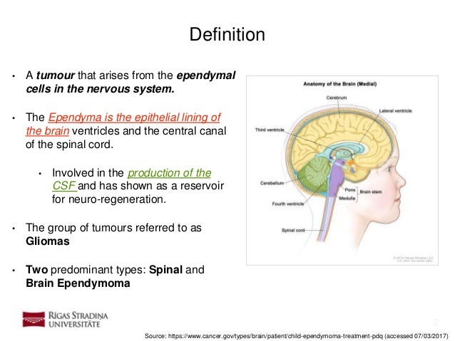 Ependymoma