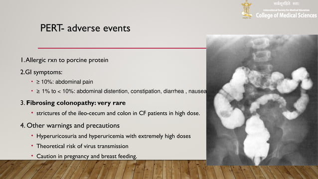 exocrine pancreatic insufficiency in pancreatic disorder.pptx